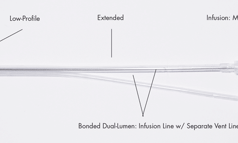ALPINE Femoral Venous Cannula by Surge - MED Alliance Solutions, LLC