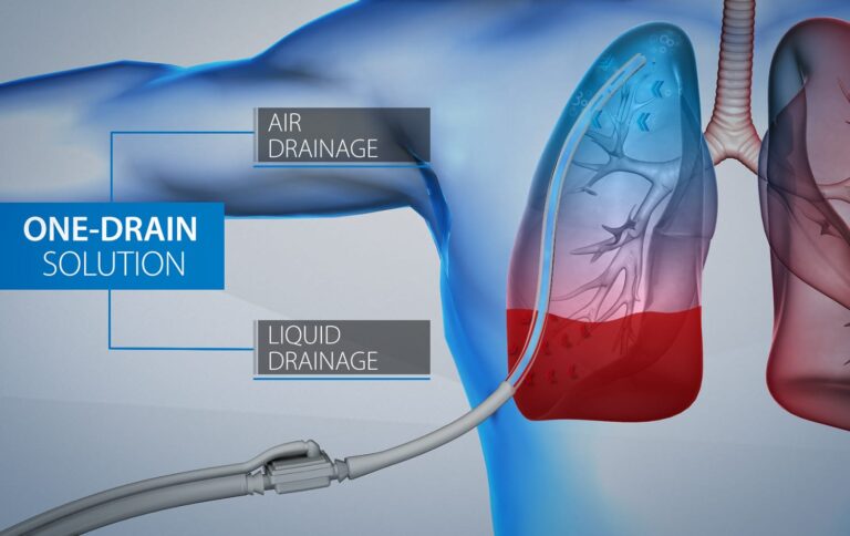Round Coaxial Thoracic Drain (One Drain Solution) by Redax - Med ...