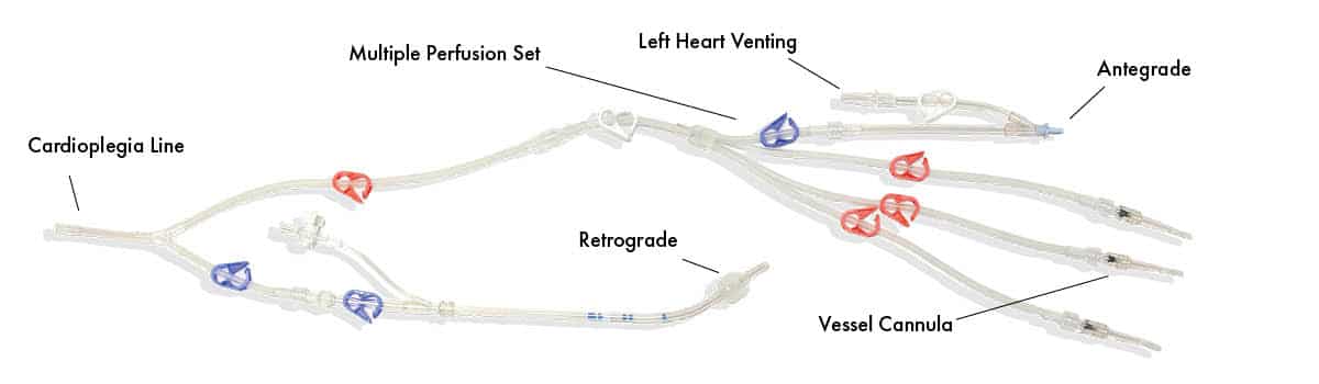 Surge Cardiovascular Perfusion Sets Allow Customized Circuit Creations ...