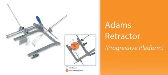 Delacroix-Chevalier: Mitral Valve Surgery Portfolio - Med Alliance ...