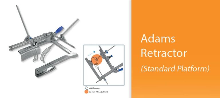 Delacroix-Chevalier: Mitral Valve Surgery Portfolio - Med Alliance ...